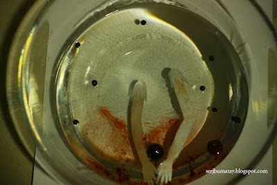 Thumbsucking: How to work with resin