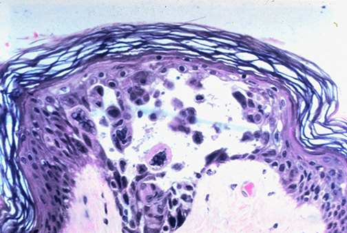 EL RINCÓN DE LA MEDICINA INTERNA. juanpedromacaluso@yahoo.com.ar ...