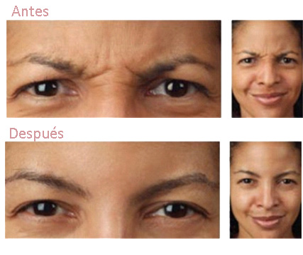 Jhuvenlight Estética Facial y Corporal