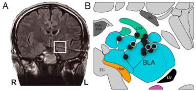 The Neurocritic: December 2017
