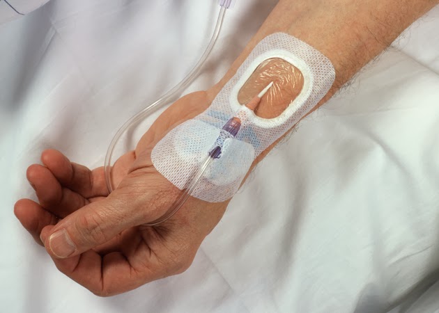 vox médica : Arterial Catheters and Risk of Bloodstream Infection