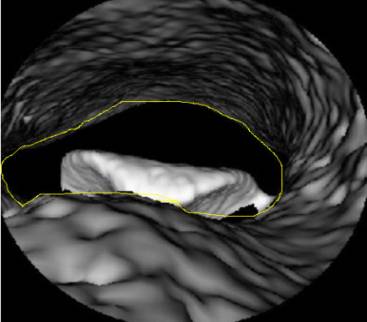 Facial Development Newsletter: THE SCIENCE BEHIND THE HOMEOBLOCK™ APPLIANCE