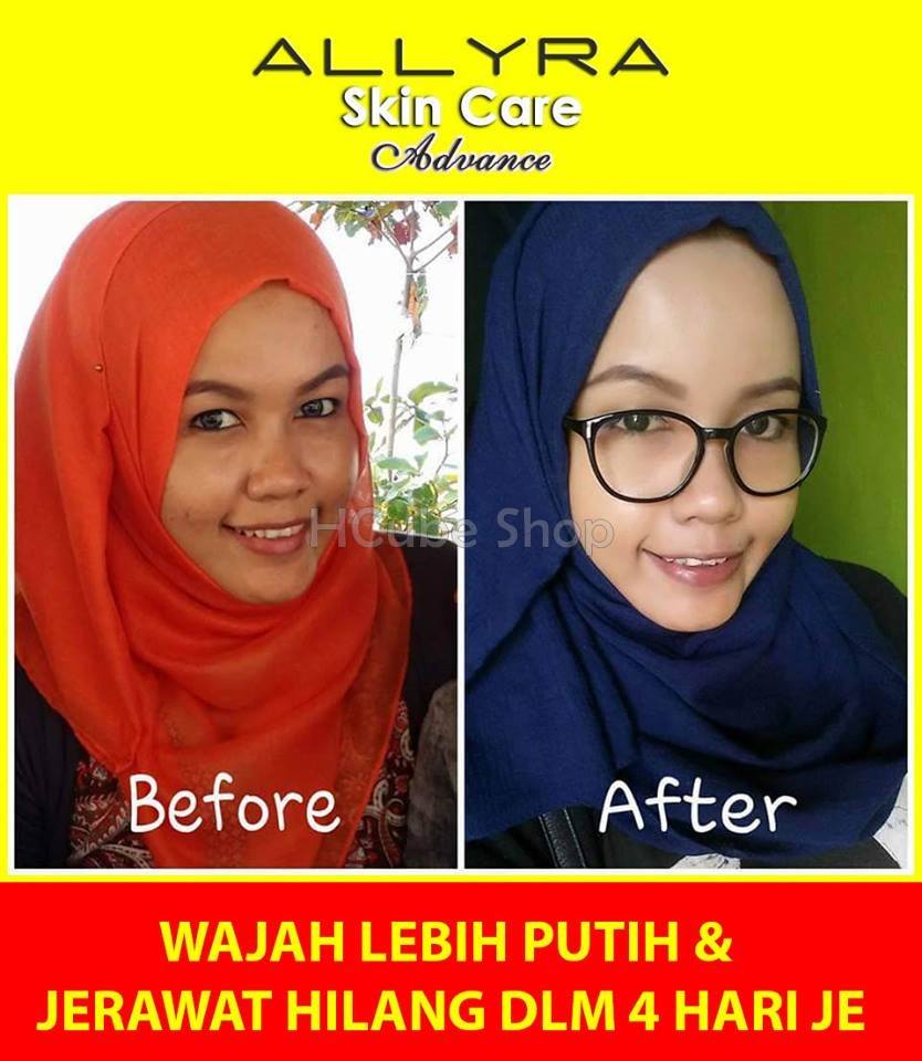 ALLYRA SKINCARE ADVANCE - TESTIMONI REVIEW KEBERKESANAN - Pengedar ...