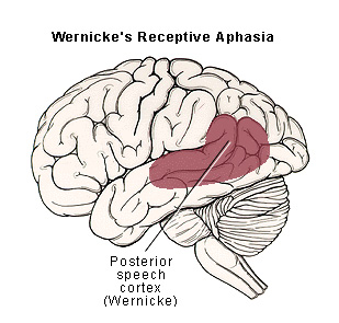Wernicke's Aphasia | All Things NP