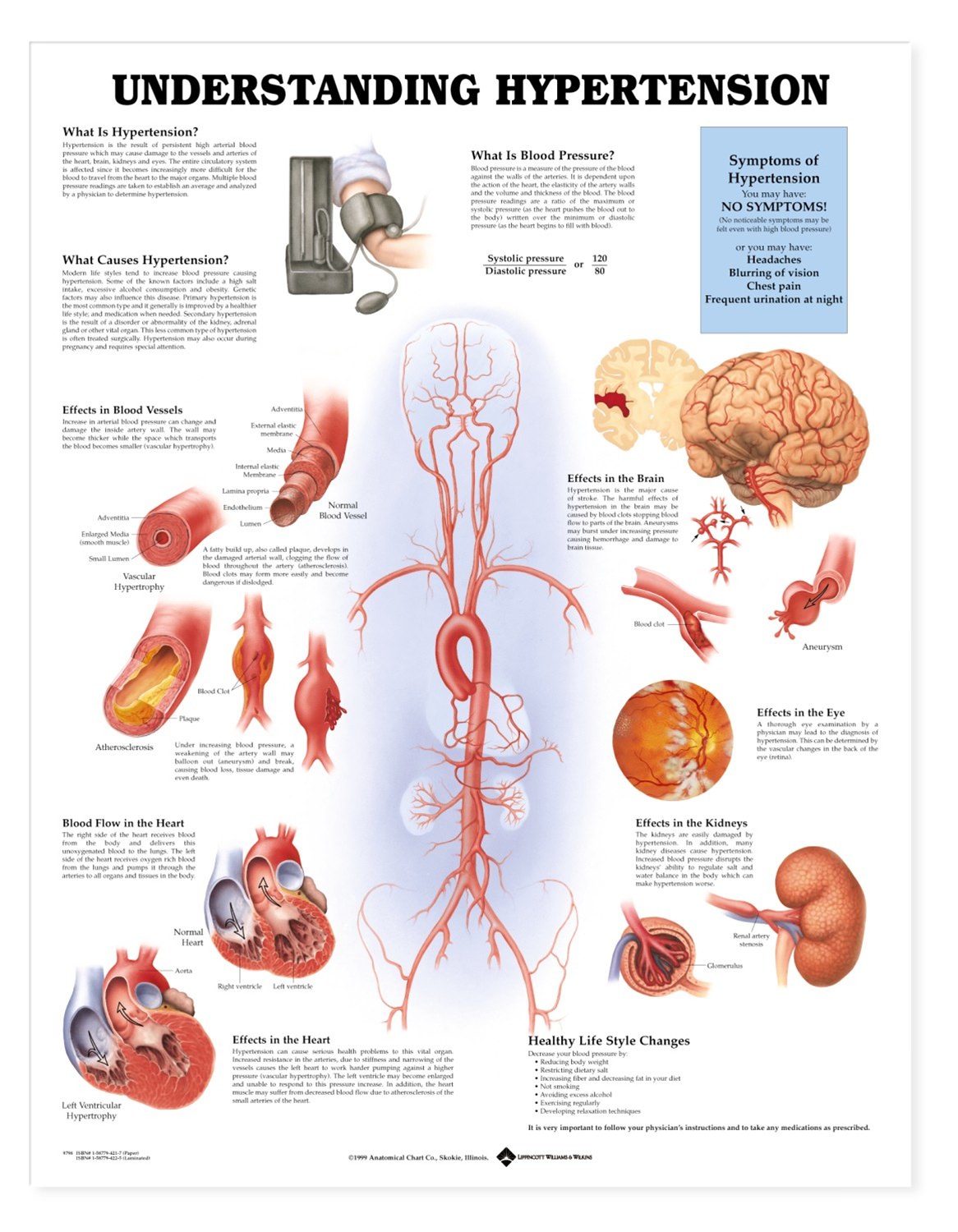 Doctor of Pharmacy: Hypertension : Explained Clearly by World class ...