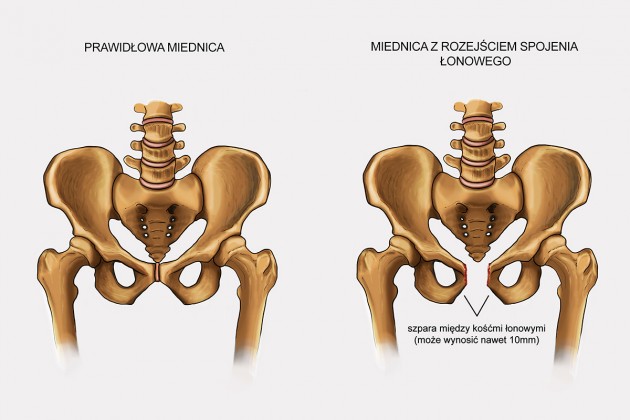 Zdrowe życie: O szkodliwości uprawiania sportu