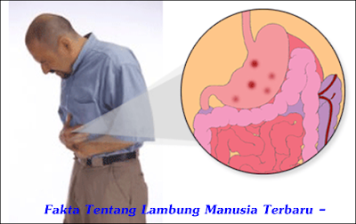 Fakta Tentang Lambung Manusia Terbaru | Gastric Health Tablet Harga ...