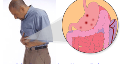 Fakta Tentang Lambung Manusia Terbaru | Gastric Health Tablet Harga ...