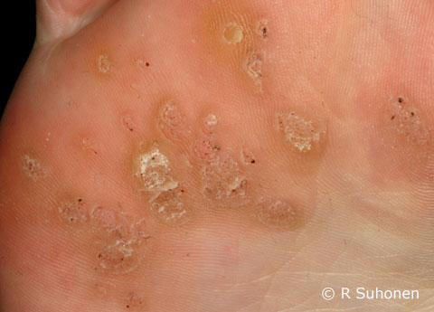 Sarin matka kosmetologiksi: jalkojenhoito