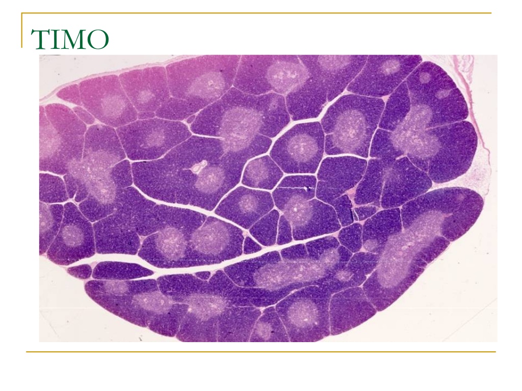 Anatomia patológica: Tema 2 Ganglios Linfaticos, Timo y Bazo