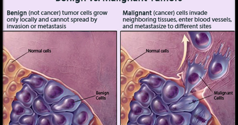 microbiology: Tumor cell lines