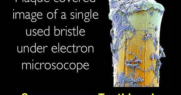 ORAL HEALTH: Germs on your Toothbrush - Ovi Dental