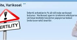 VARİKOSEL İLE İLGİLİ YAŞADIKLARIM - Düşünmek ve Paylaşmak