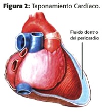 Semiologia Quirurgica: EXAMEN DEL TORAX