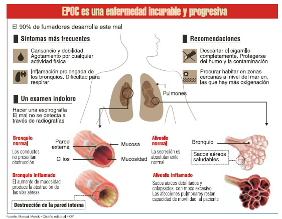 Medicina UNLP - Patología: Enfermedad pulmonar obstructiva crónica - EPOC