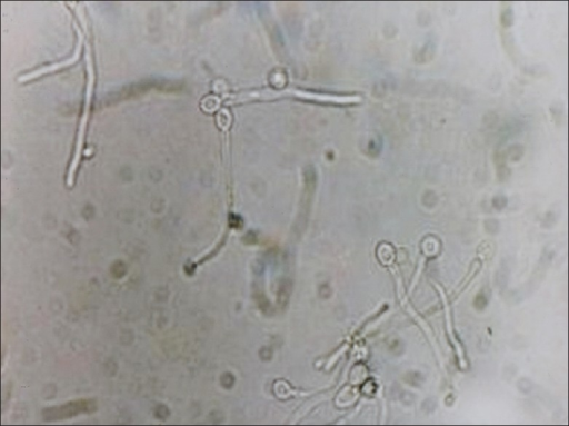 Germ Tube Test For Candida albicans | Laboratory Stack