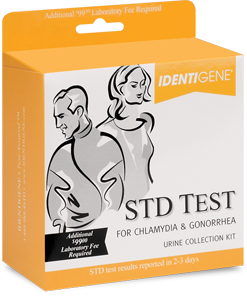 at home std test