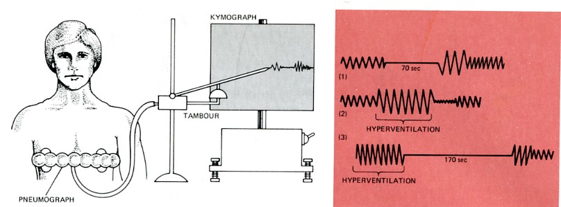 11/07/10 ~ TUNTUNGAN BLOG