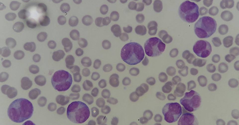 A Dull Day At Work...?: 6 October 2016 (Thursday) - Buttock cells ? (!)