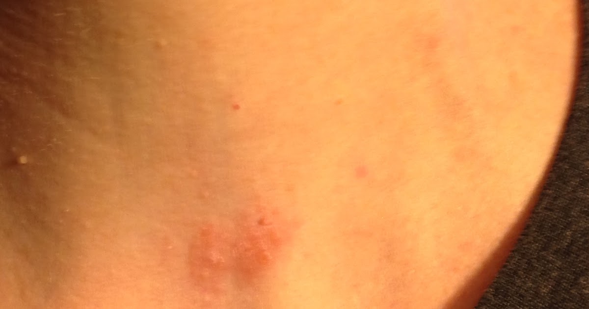 Naturally Nickel-Free Artisan Jewelry: This is How It Happens