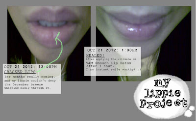 V&M NATURALS: TRUE CONFESSION: CRACKED BLEEDING LIPS HEALED IN AN HOUR!