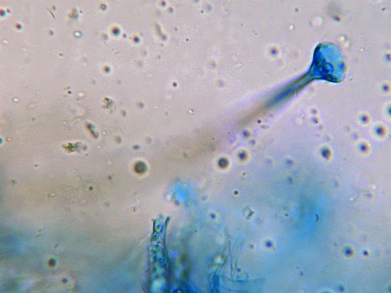 Fun With Microbiology (What's Buggin' You?): Apophysomyces elegans ...
