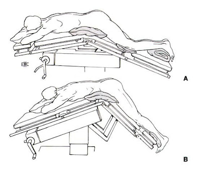 Taysir assistance الإسعاف الطبي تيسير: Position dite " jack-knife ".