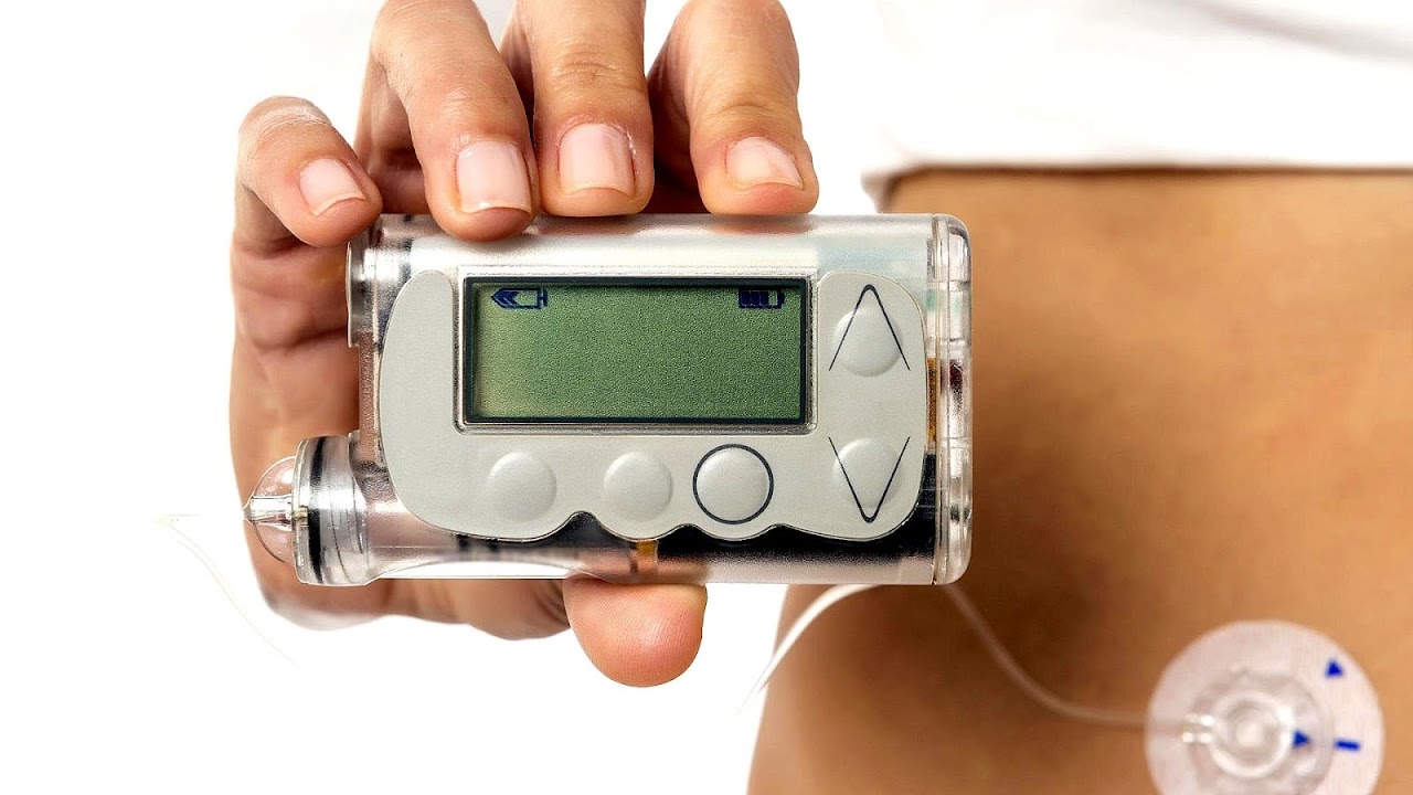 Blood glucose monitoring Insulin - Insulin Choices