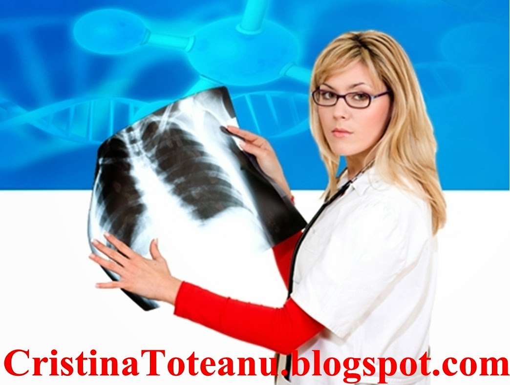 Dr. Cristina Toteanu: Tratamentul pleureziei tuberculoase - Scheme de ...