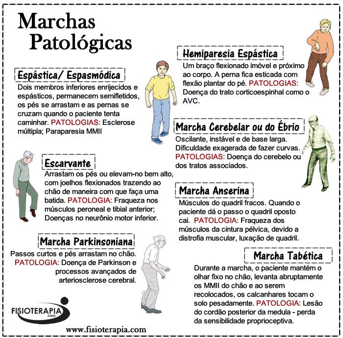 Fisioterapia Domiciliar: Marchas Patológicas
