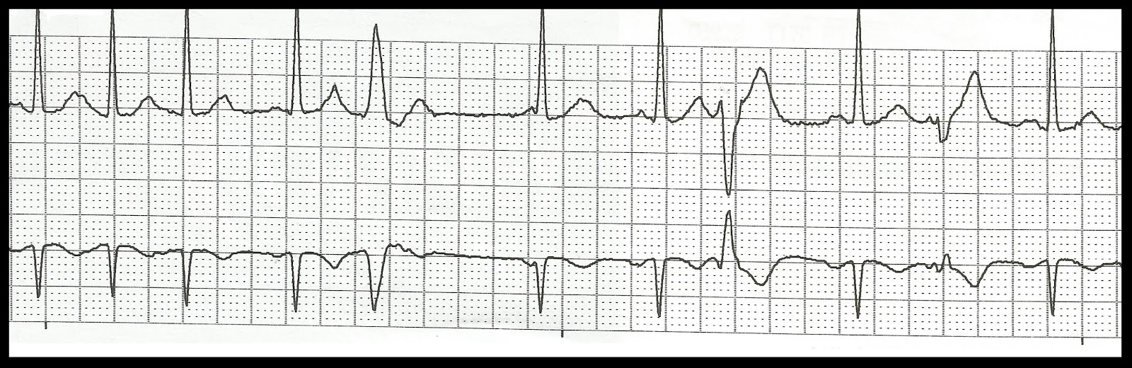Basic EKG Rhythm Test 08