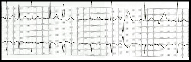 Basic EKG Rhythm Test 08