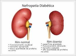 Nefropatia diabética