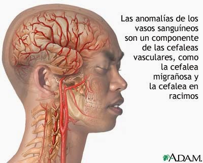 ATENCION CUERPO Y ALMA: MIGRAÑAS Y CEFALEAS
