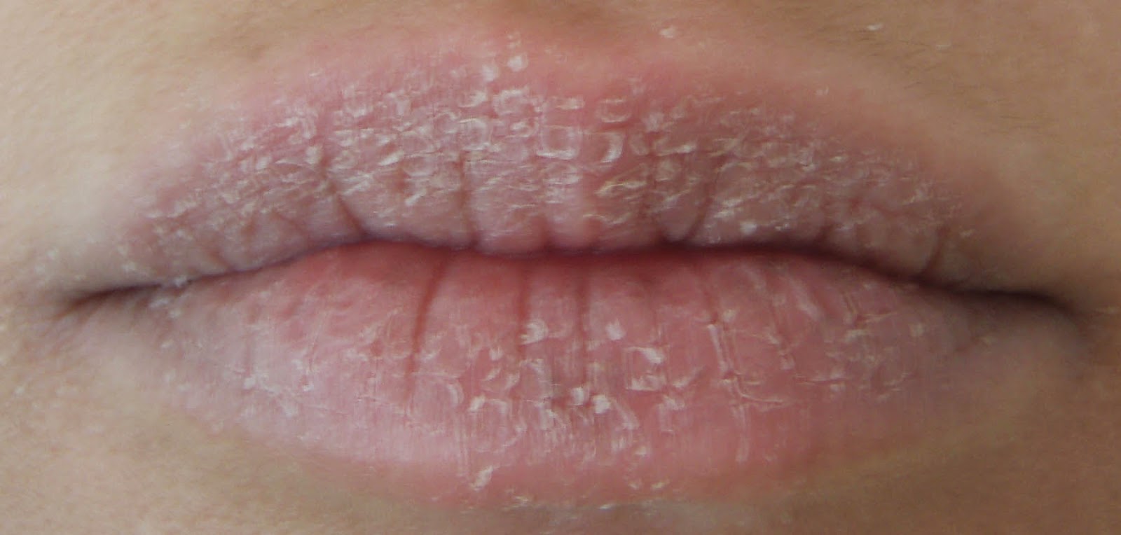 Health & Beauty: Learning to make peeled natural lips