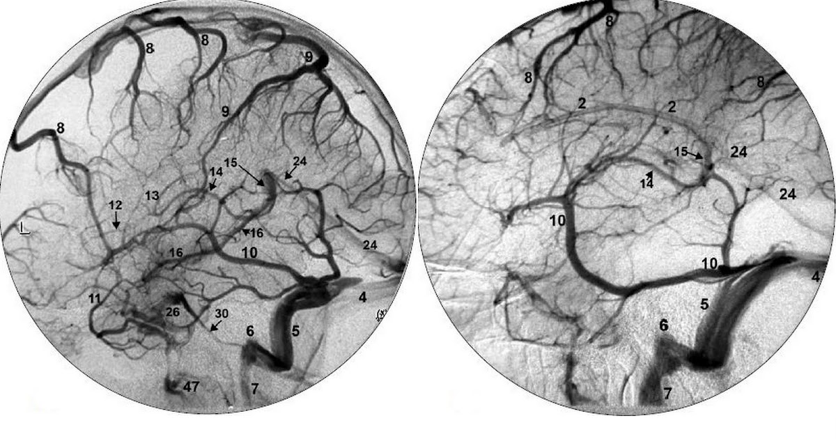 Dr Balaji Anvekar FRCR: Normal intracranial venous system
