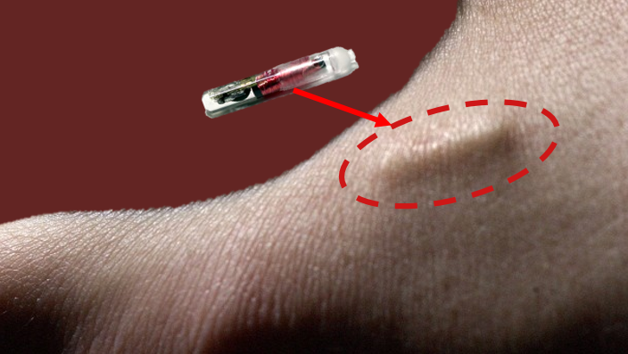 Eggetsberger-Info, Blogger, Blog: Auch in Österreich lassen sich ...