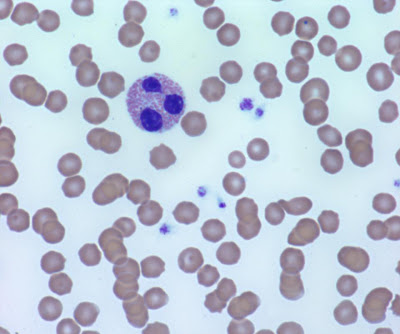 VETERINARY HEMATOLOGY DEXTERVET: eosinophils from a cat, note the rod ...