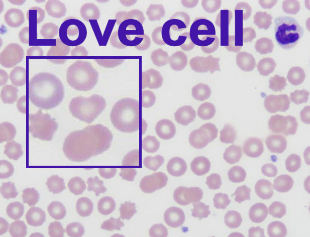 Medical Laboratory and Biomedical Science: Lovely erythrocyte