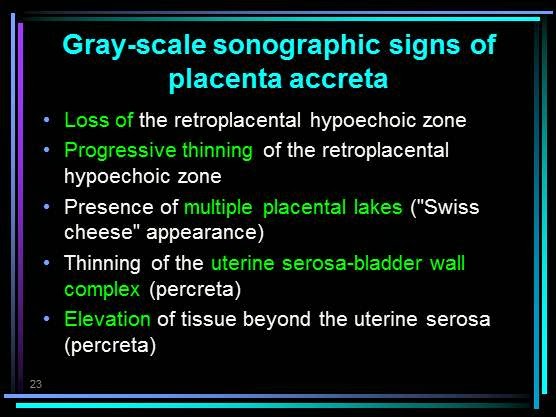 The Well-Rounded Mama: Placenta Accreta, Part Four: Diagnosis ...