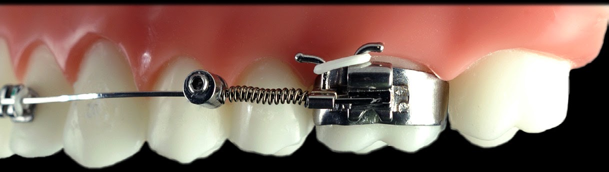 Embracing Innovative Orthodontics - Portage, Kalamazoo, Paw Paw, MI ...