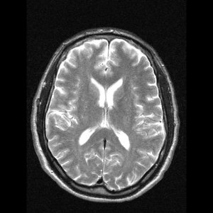 CT Concussion Task Force