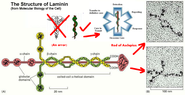 KairosFocus: Matt 24 watch, 124: On the Laminin Cross and the Hubble ...