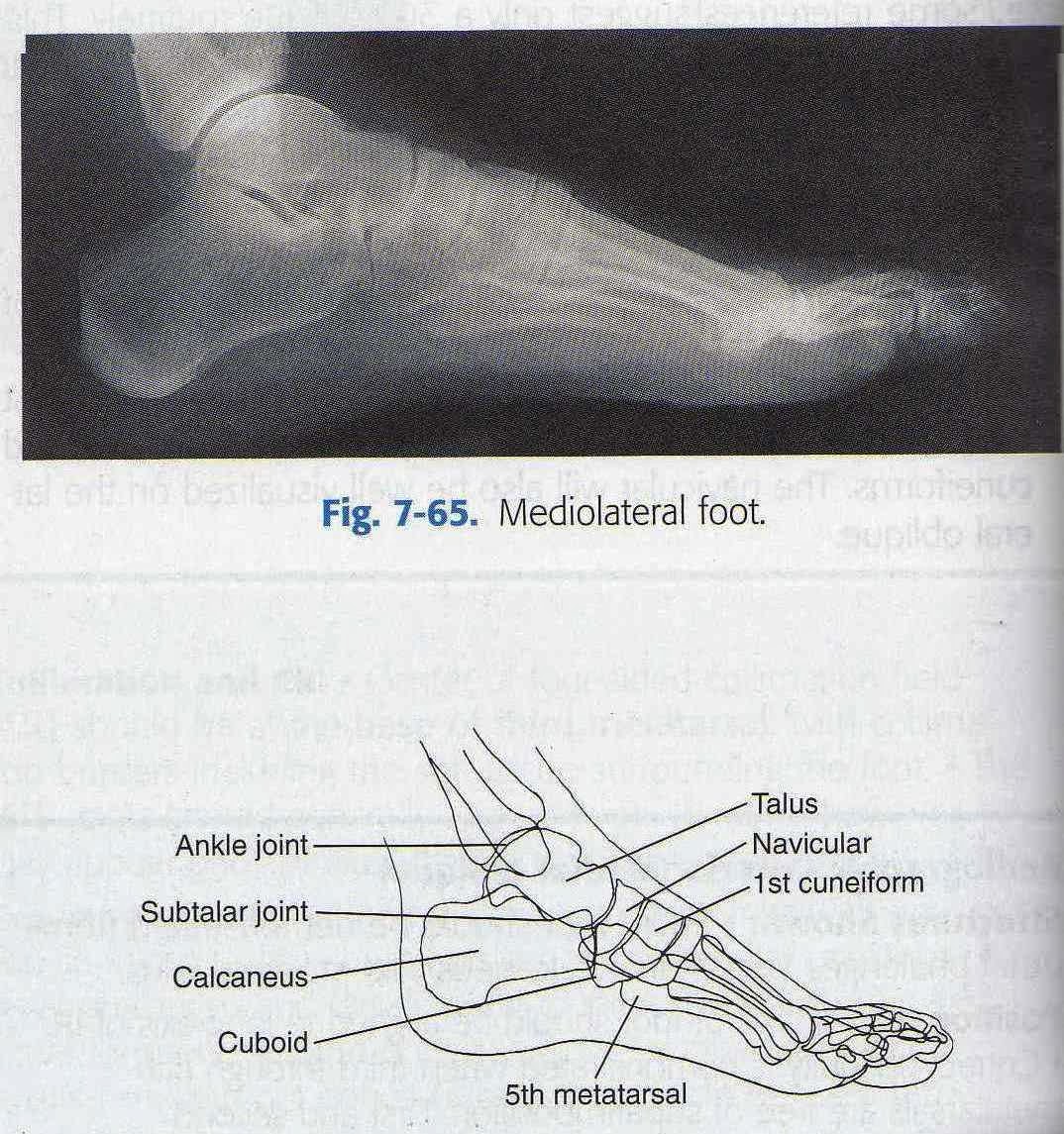 Teknik Radiografi Ossa Pedis ~ RADIOLOGI
