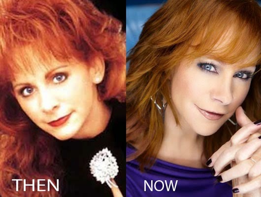 Reba McEntire Plastic Surgery