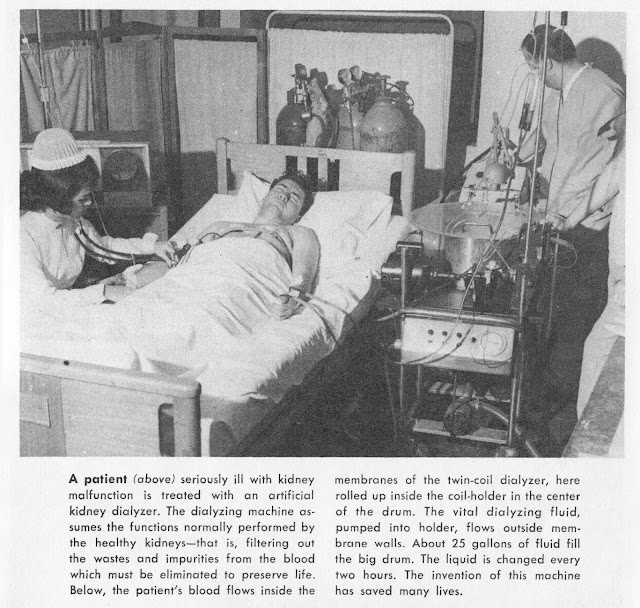 Progress is fine, but it's gone on for too long.: Dialysis machine, 1970