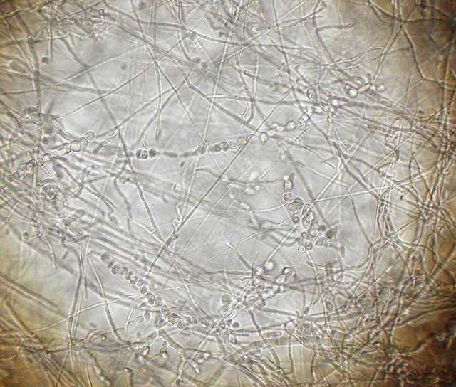 ATLAS MICOLOGIA: SCYTALIDIUM DIMIDIATUM (Neoscytalidium dimidiatum)
