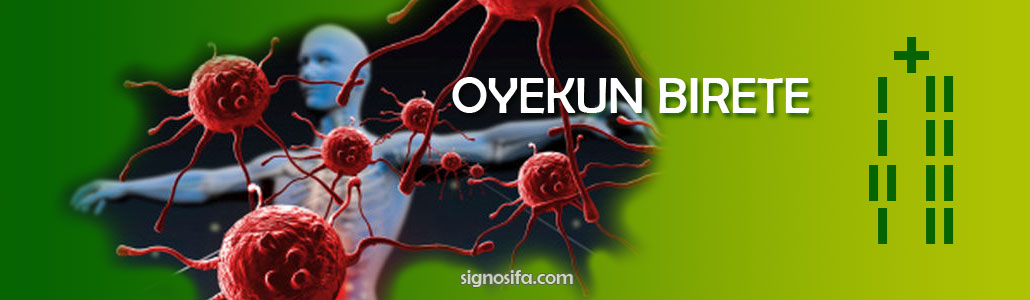 Oyekun birete - Signos de Ifá