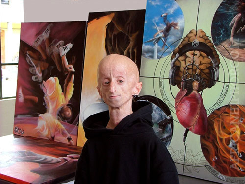 Hero of the Day: Leon Botha