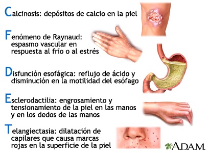 Enfermer@s al Rescate: S. CREST